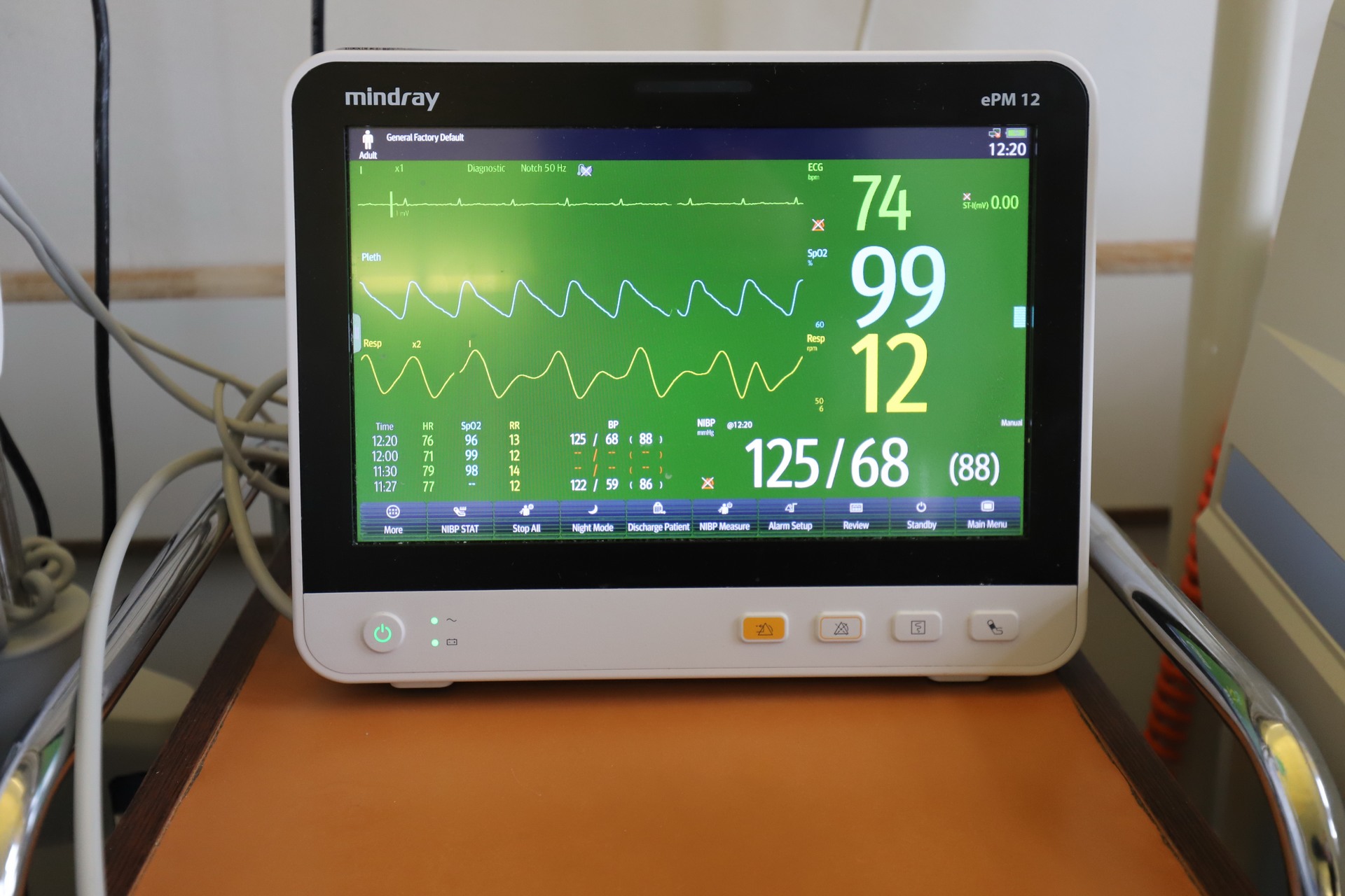 8 monitora za kontinuirano praćenje vitalnih funkcija bolesnika ...