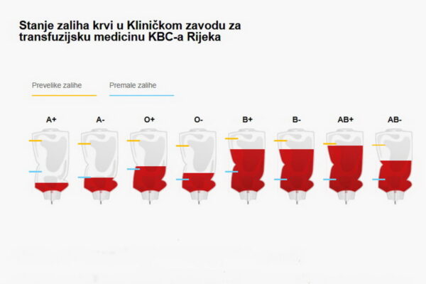 Apel darivateljima krvi – nedostatne zalihe A+, A- i 0- – Grad Rijeka
